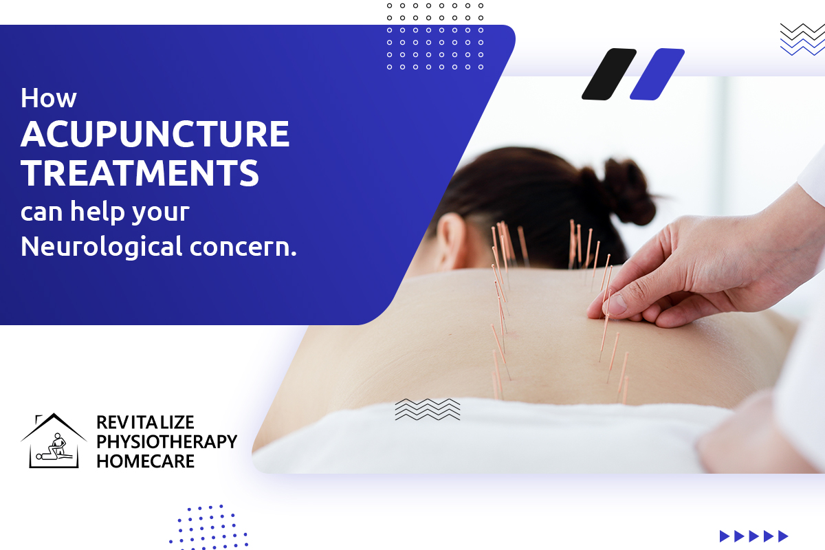 Benefits of Acupuncture Treatments for Neurological Health